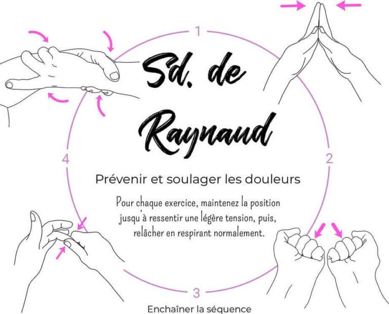 Exercices pour calmer les crises du syndrome de Raynaud