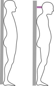 Lutter contre l'hypercyphose par des exercices d'ostéopathe