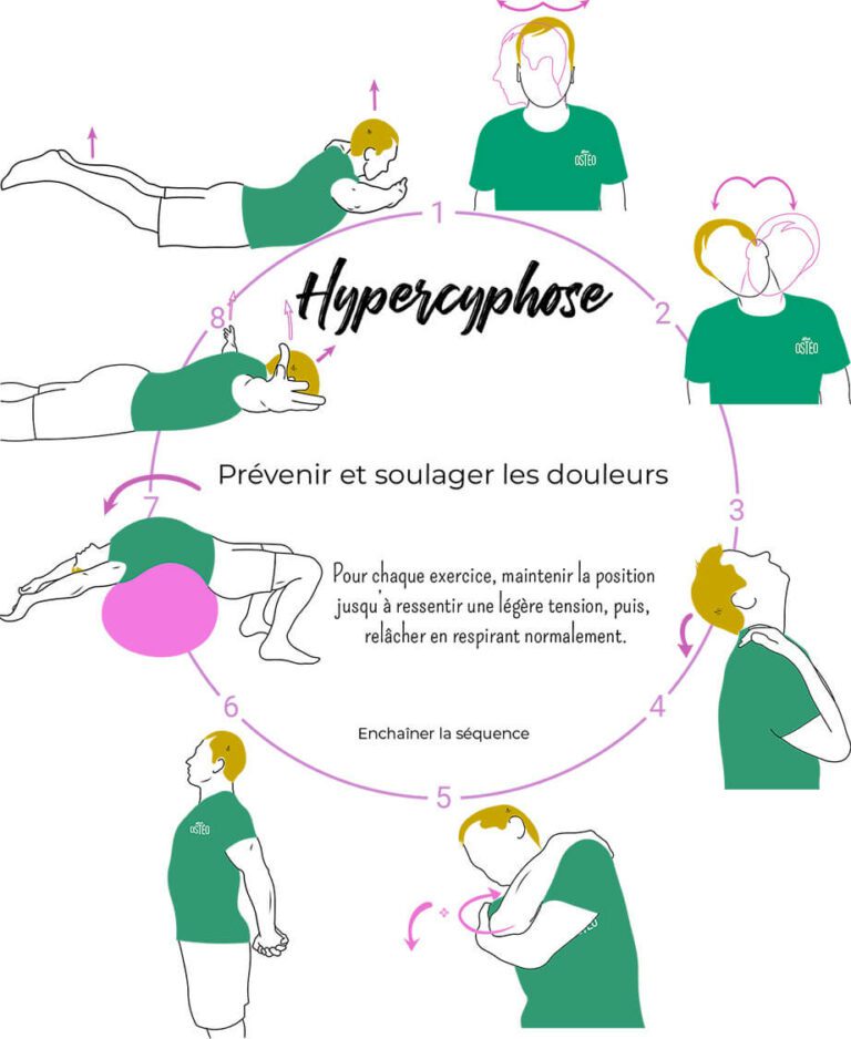 Lutter contre l'hypercyphose par des exercices d'ostéopathe